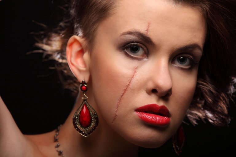 Face Scars From Car Accident – 4 Things a Victim Should Know